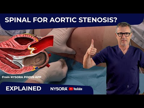 IS SPINAL ANESTHESIA IN AORTIC STENOSIS SAFE?