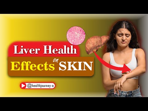 The SHOCKING Truth About Your Skin and Liver Health Connection