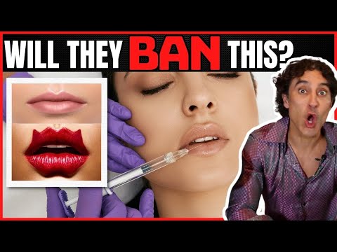 π THE REAL DANGERS of LIP FILLER π // Lip Fillers