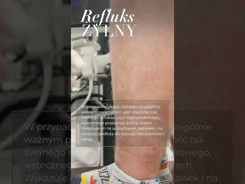Jak wygląda badanie USG Doppler?👏🏻 Diagnostyka żylaków i niewydolności żylnej