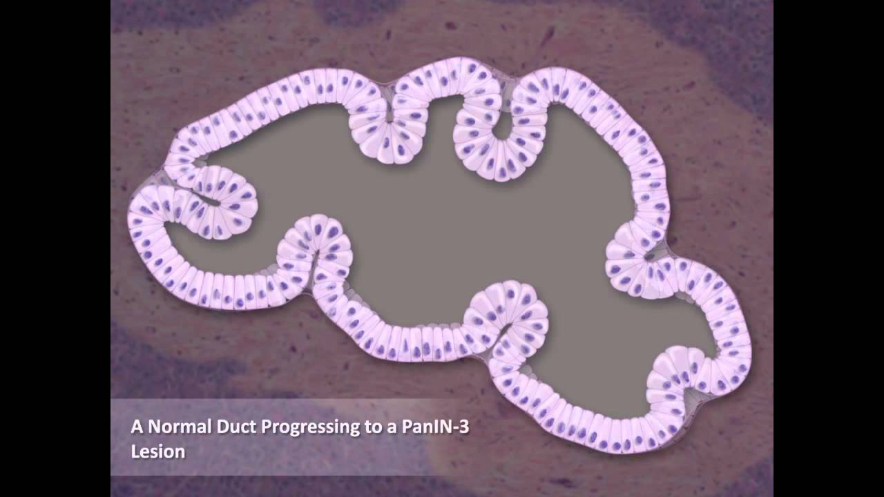 Haphazard Growth Pattern