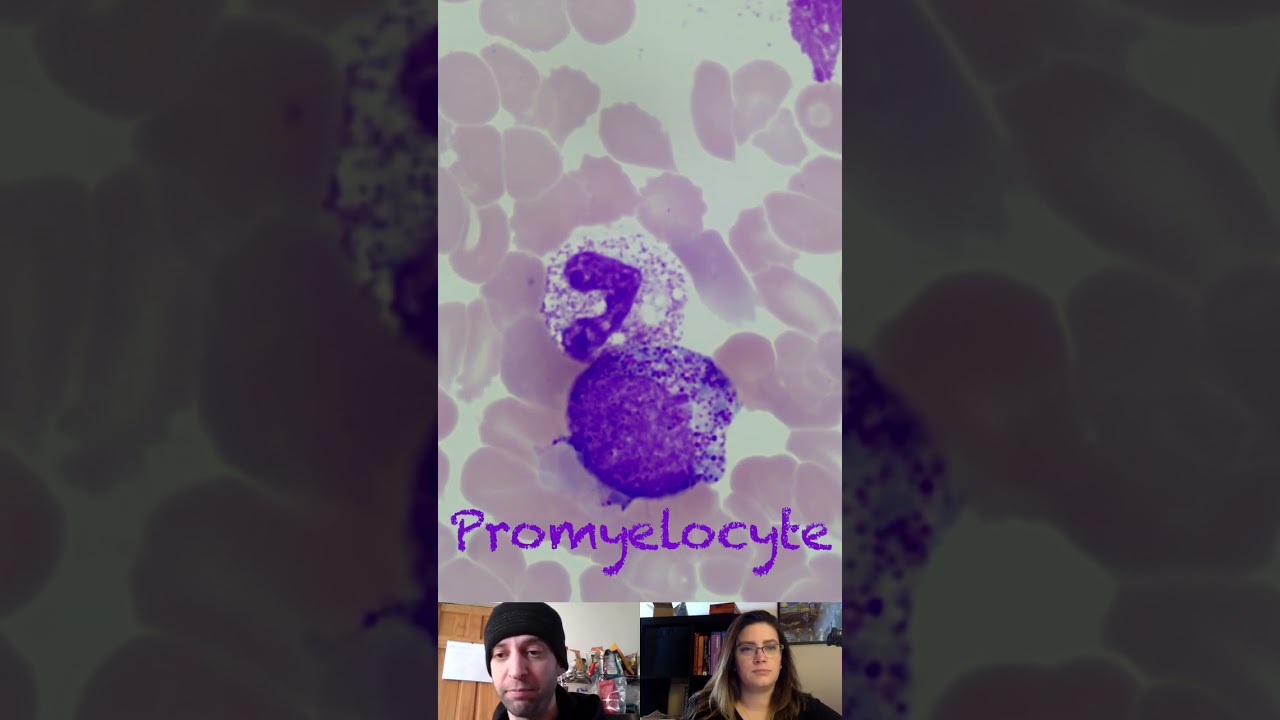 Promyelocyte Morphological Characteristics