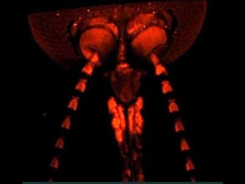 Most Dangerous Animal on the Planet - Bloodsucking Mosquito Mouthparts and Eyes