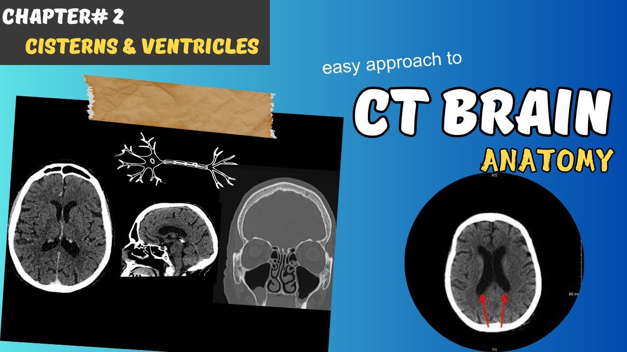 Cisterns & Ventricles |CT BRAIN| Chapter# 2