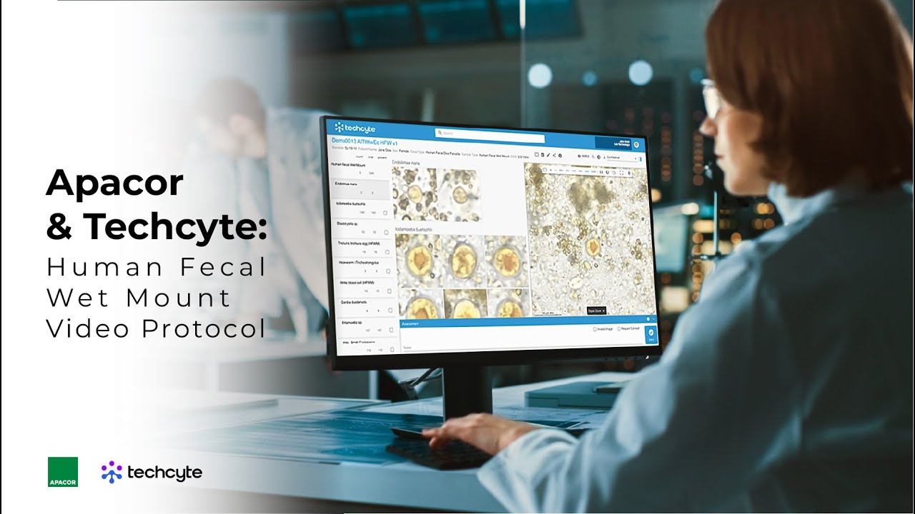 Apacor & Techcyte: Human Faecal Wet Mount Video Protocol