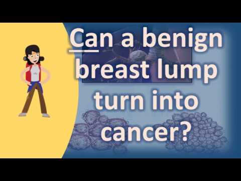 Can a benign breast lump turn into cancer ? |Health Issues & Answers