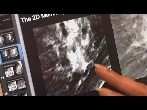 Breast cancer is leading cause of death in Black women, according to report