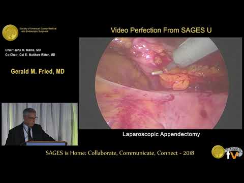 Laparoscopic appendectomy