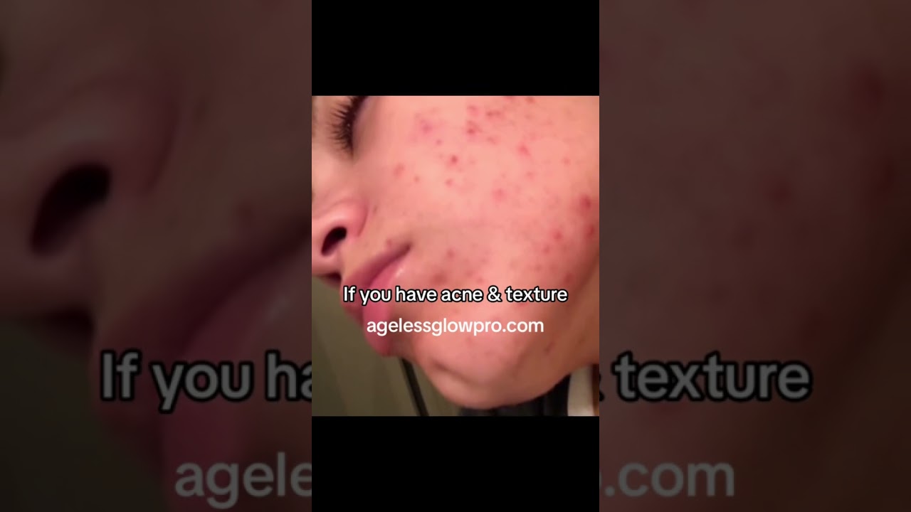 Jawline in minutes🤫 #jawlines #glowingskincheck #clearskin #skintransformations