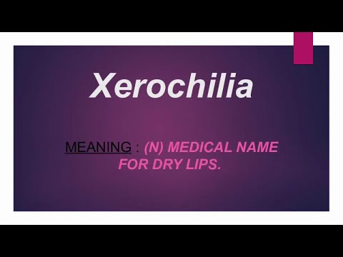 15 words that start with X (part 2)