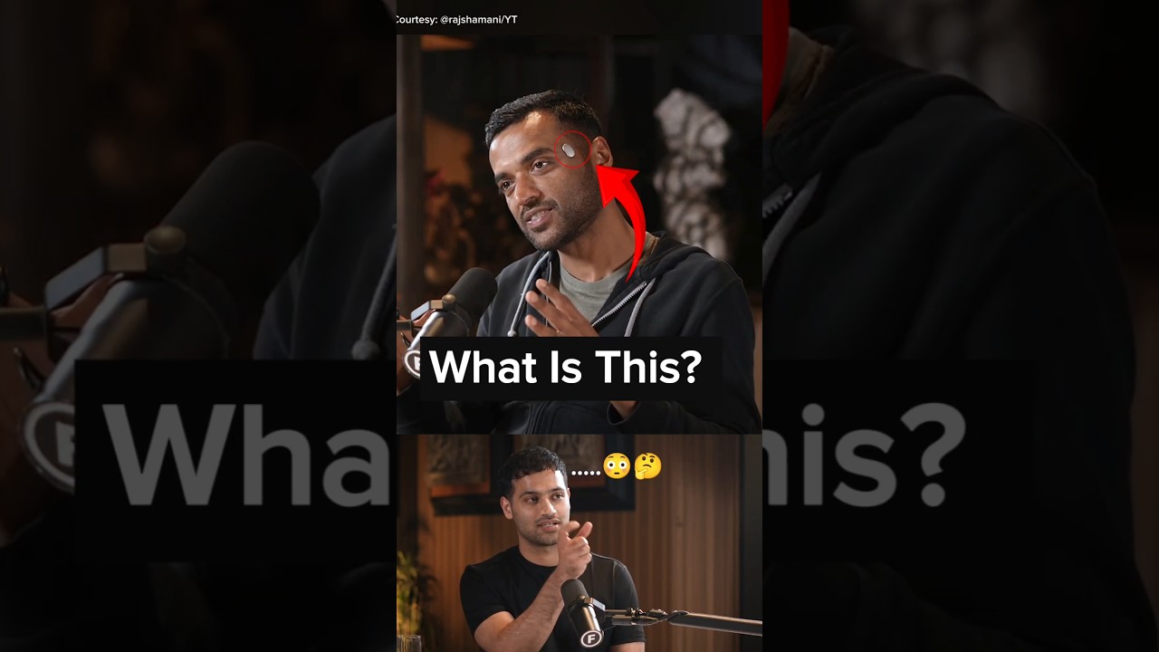 What's the Silver Device Near Deepinder Goyal's Eye?😳🤔 | Raj Shamani Podcast | Temple Device