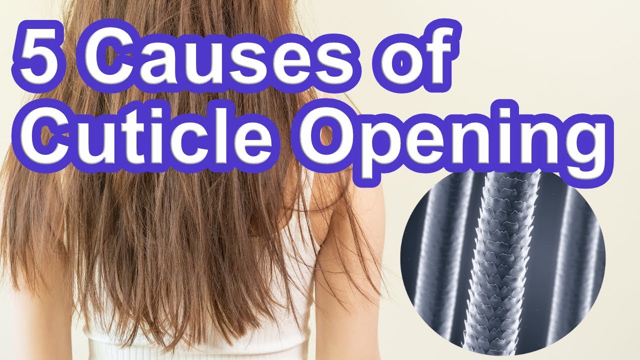 5 causes of cuticle opening
