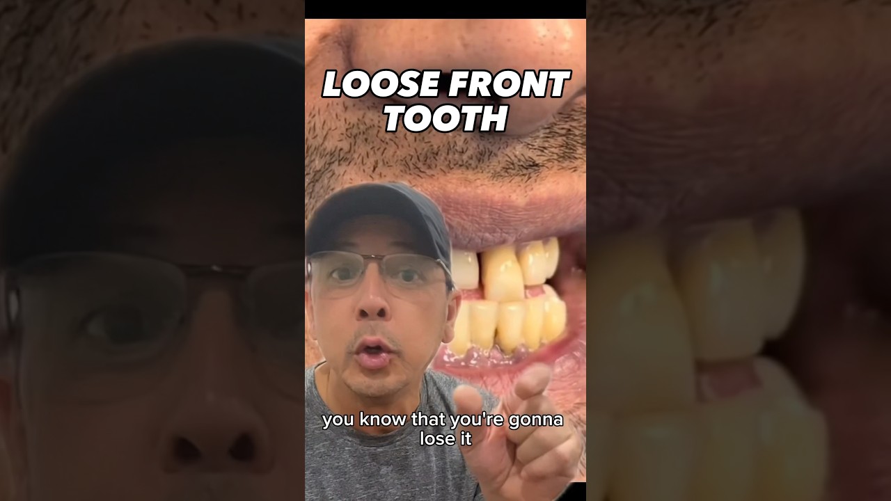 What to Do If You Have a Loose Front Tooth | In Office to Hands On Dental Training #shorts