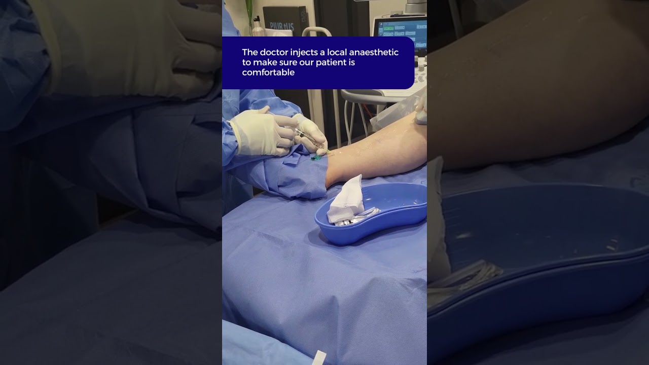 Our Laser Treatment Process #treatment #varicoseveins #varicoseveinstreatment