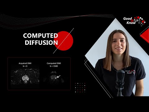 Good to Know - Computed Diffusion (cDWI)