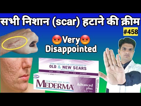 Mederma cream | mederma for acne scars | mederma advanced scar gel review