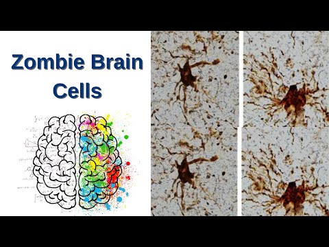 zombie brain cells that come to life after we die ! | neuroscience ...