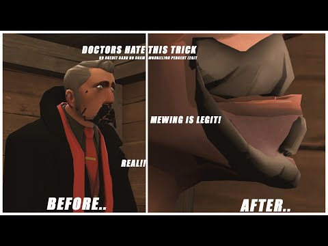 Steam Community :: Video :: MEWING #mewing #tf2 #chin