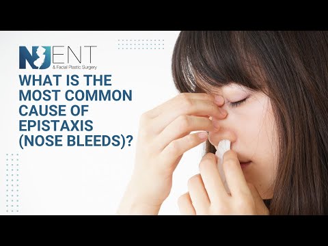 What is the Most Common Cause of Epistaxis (Nosebleeds)? | We Nose Noses
