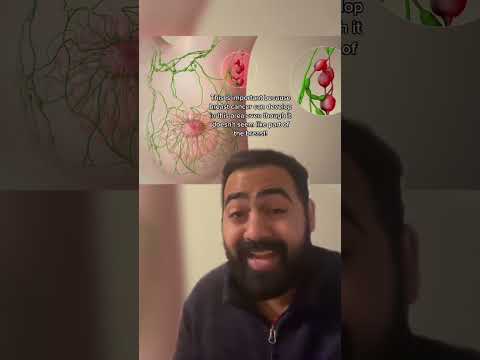 Doctor Reveals Three Hidden Breast Cancer Spots!