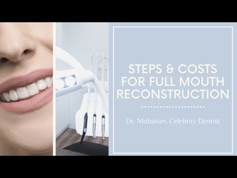 Full Mouth Reconstruction Dentist Procedure Los Angeles