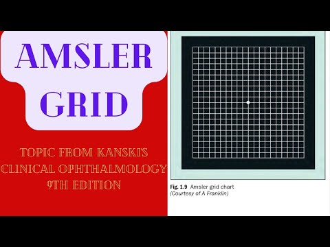 Amsler grid-Kanski's clinical ophthalmology #amsler grid #ophthalmology #optics #medical