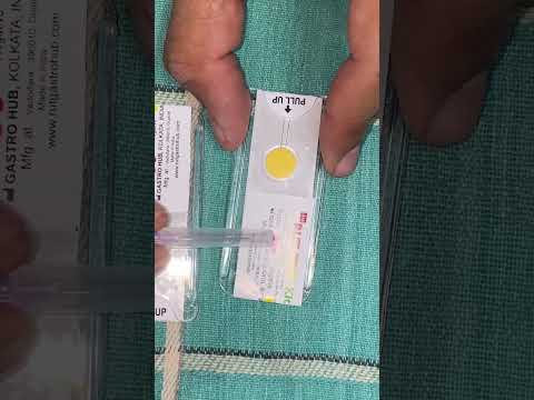 HOW TO DO RAPID URIASE TEST | RUT TEST NEGATIVE #hpylori #rut
