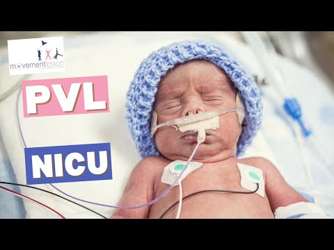 PVL Periventricular Leukomalacia Atypical Development Baby, We just got a diagnosis.