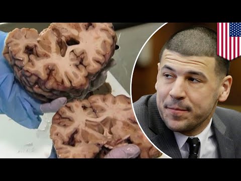 Research shows Aaron Hernandez’s brain had severe damage with signs of CTE - TomoNews