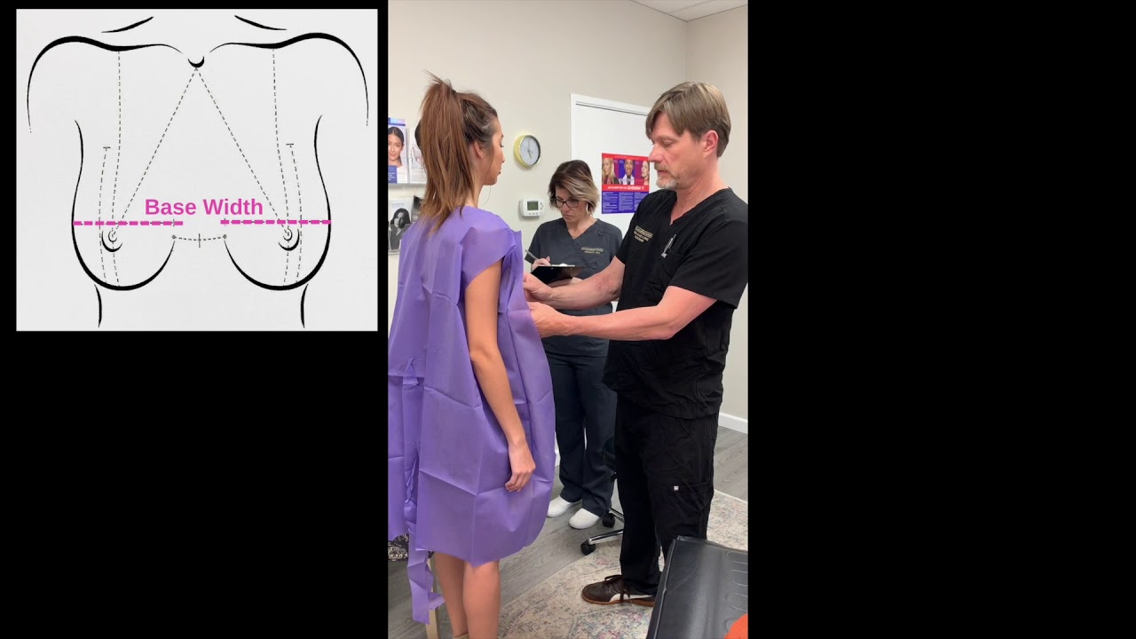 Breast Augmentation Consult