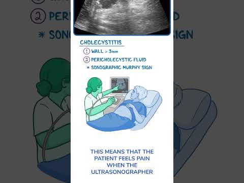 Diagnostics on Demand: Cholecystitis