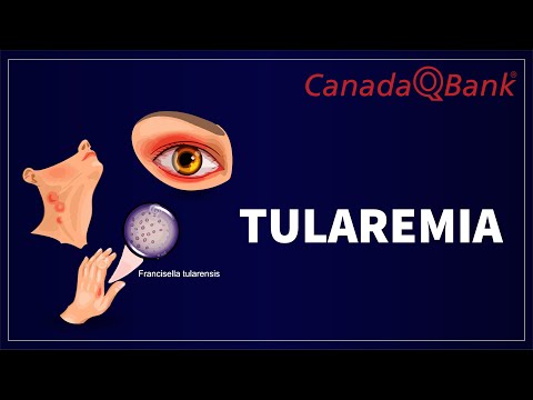 Tularemia: Causes, Symptoms, Diagnosis & Treatment | CanadaQBank