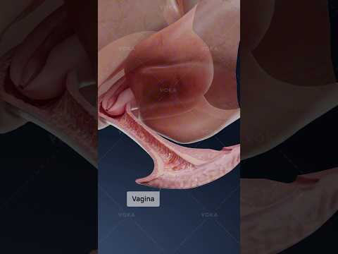 What is herpetic vaginitis and how does it affect the vagina? Explore gynecology in 3D with VOKA