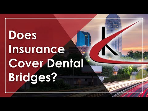 Does Insurance Cover Dental Bridges? | Winston-Salem Dentist | Matthew Keider, DDS