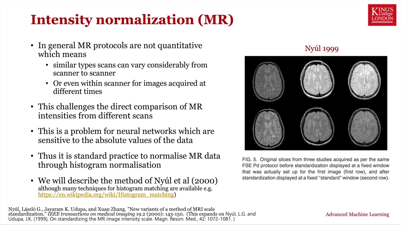 week3 video4: Improving performance through preprocessing