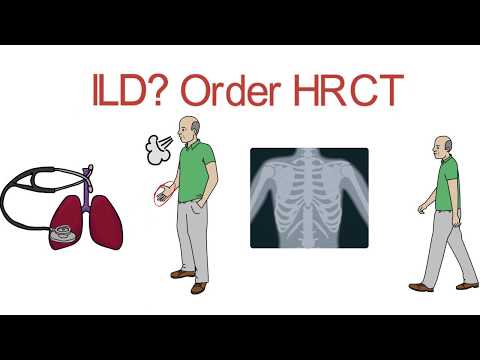 How to Recognize and Diagnose IPF