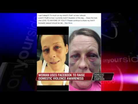 Woman posts shocking pictures to Facebook to raise awareness about domestic violence