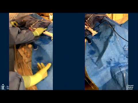 CVI 2019_Thursday 7/18_ PCI how to part 1: the basics_Duane Pinto, MD, MPH