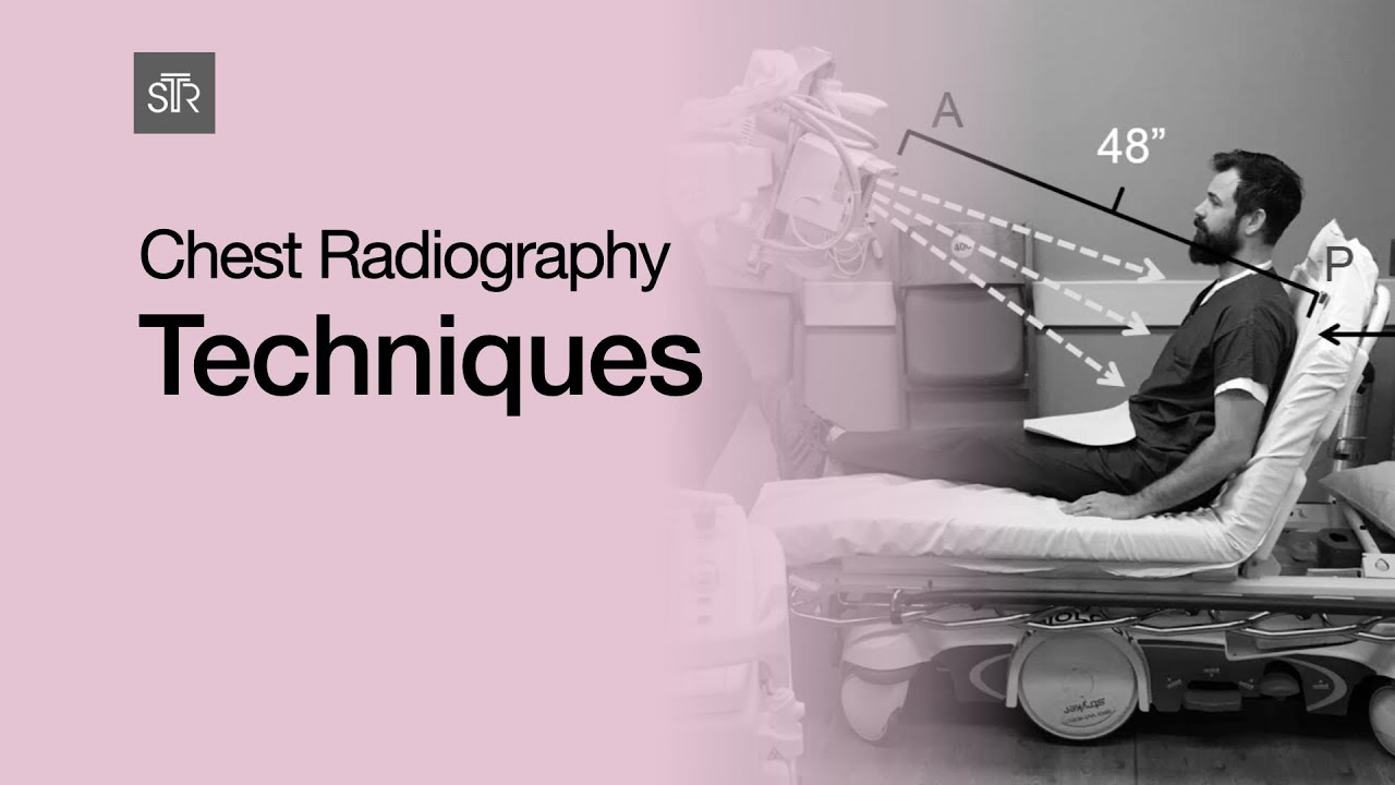 Chest Radiography: Techniques