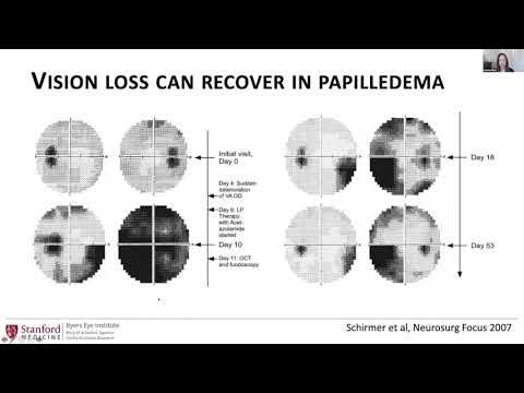Clinical Presentation and History - Mechanism of vision loss in papilledema