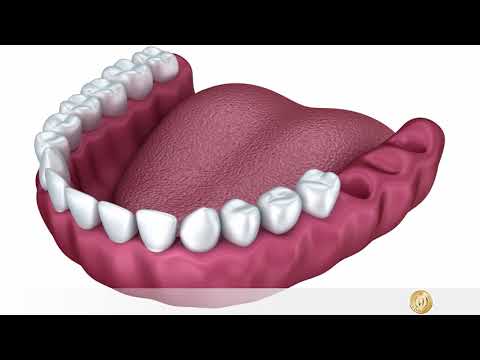 Implantology: Replacing missing teeth and improving your smile