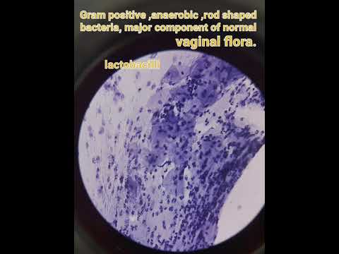 PAP smear# cervical cytology# lactobacillus spp.( Doderlein's bacilli)# pathology.