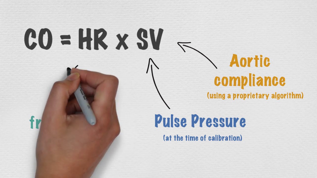Introduction to HD ICG US