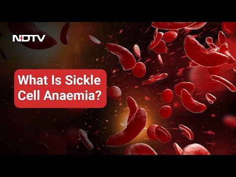 India's Mission To Eradicate Sickle Cell Anaemia