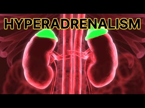 Cushing Syndrome and Hyperadrenalism (updated 2023) - CRASH! Medical Review Series