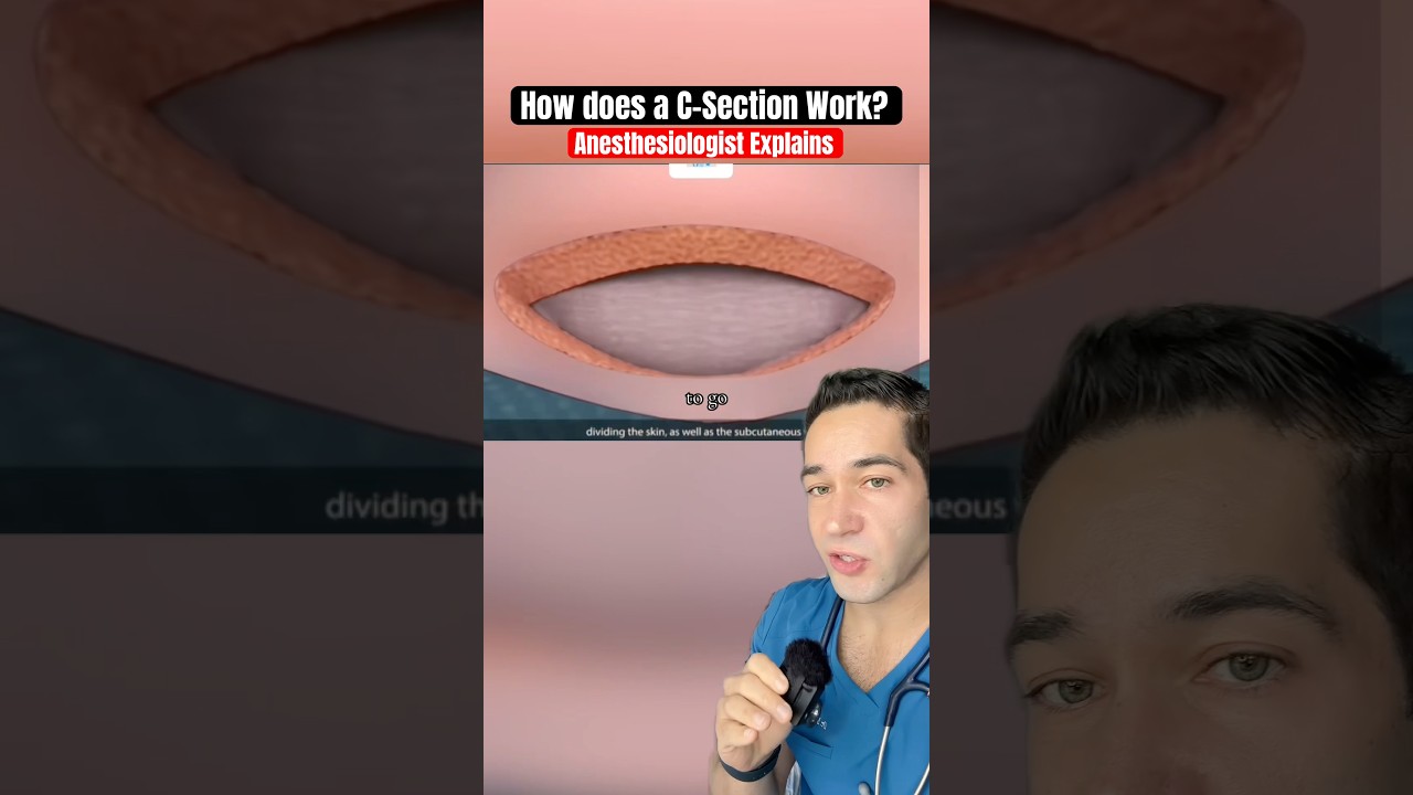 How do C-Sections REALLY work?