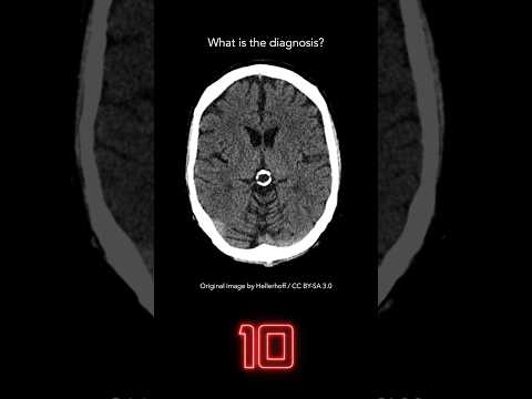 Brain CT Question 25