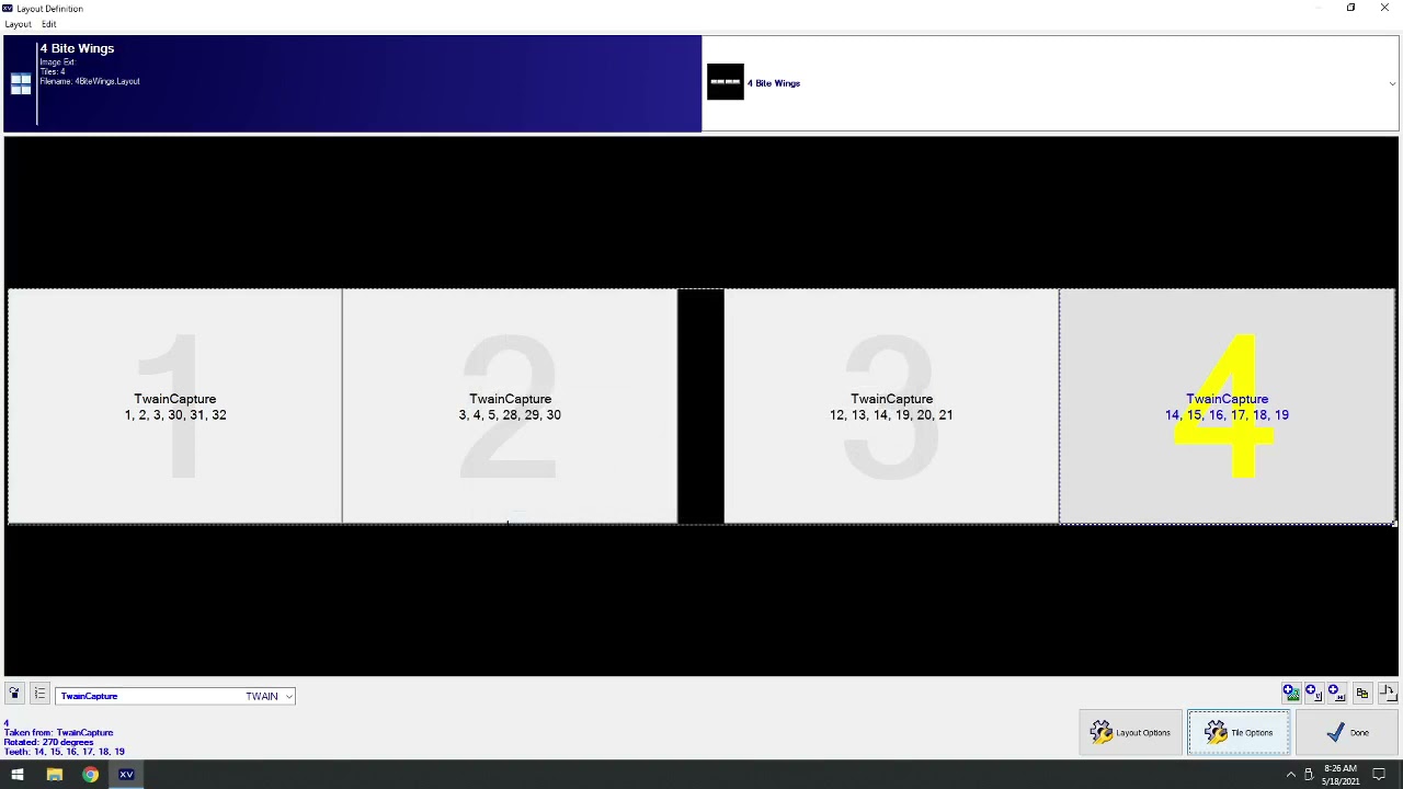 Digital Doc Blu XRayVision Integration