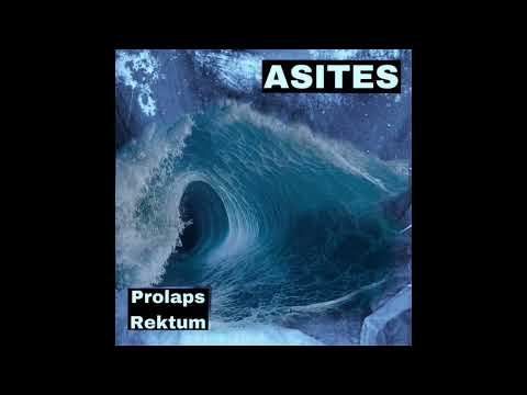 Asites - Prolaps Rektum (2024)