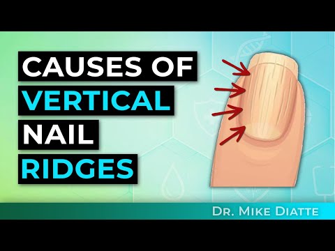 The Cause Of Vertical Ridges on Your Nails
